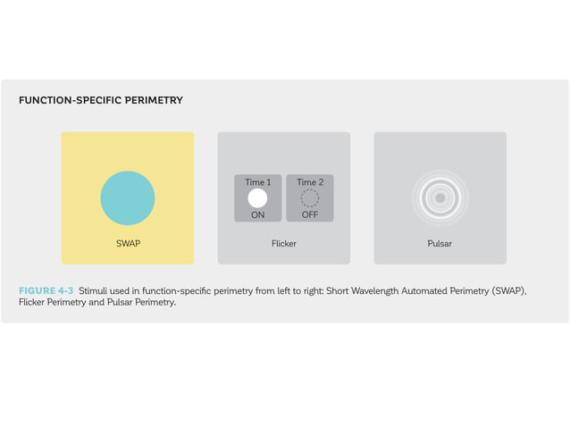Interpretation of visual fields with special reference to octopus | PDF