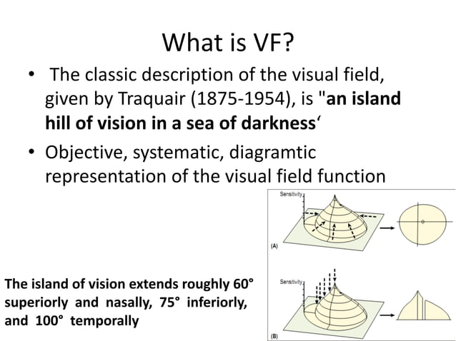 Interpretation of visual fields with special reference to octopus | PDF