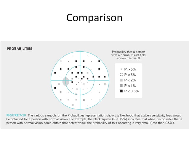 Interpretation of visual fields with special reference to octopus | PDF