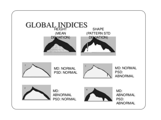 Interpretation of visual fields with special reference to octopus | PDF