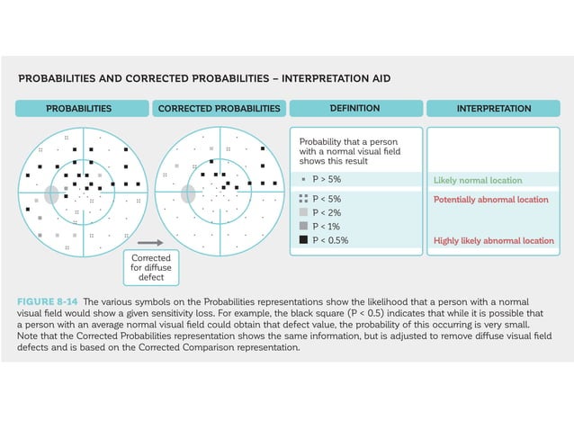 Interpretation of visual fields with special reference to octopus | PDF