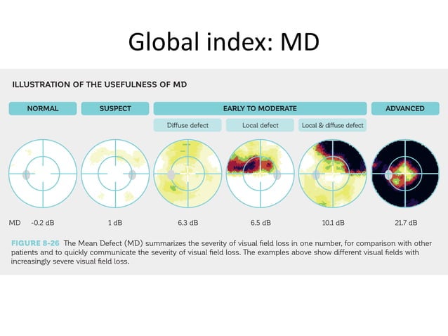 Interpretation of visual fields with special reference to octopus | PDF