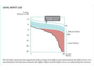 Interpretation of visual fields with special reference to octopus | PDF