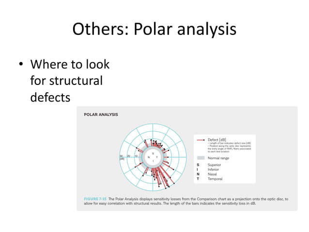 Interpretation of visual fields with special reference to octopus | PDF