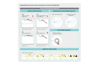 Interpretation of visual fields with special reference to octopus | PDF