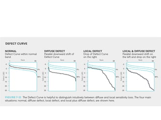 Interpretation of visual fields with special reference to octopus | PDF