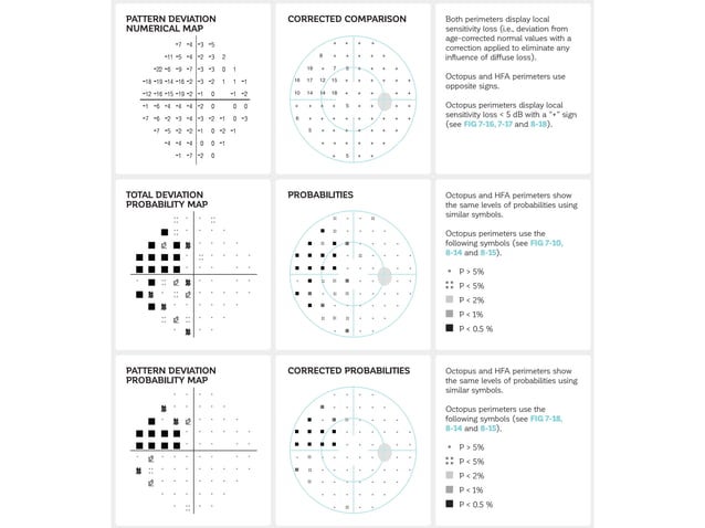Interpretation of visual fields with special reference to octopus