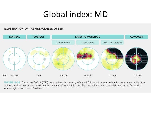 Interpretation of visual fields with special reference to octopus