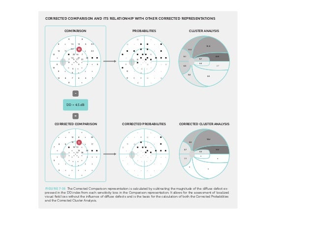 Interpretation of visual fields with special reference to octopus