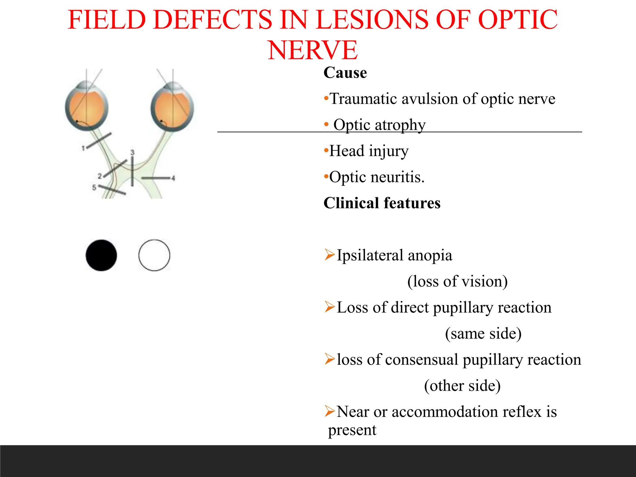 visual fields in neuro ophthalmology-part 1 | PPTX