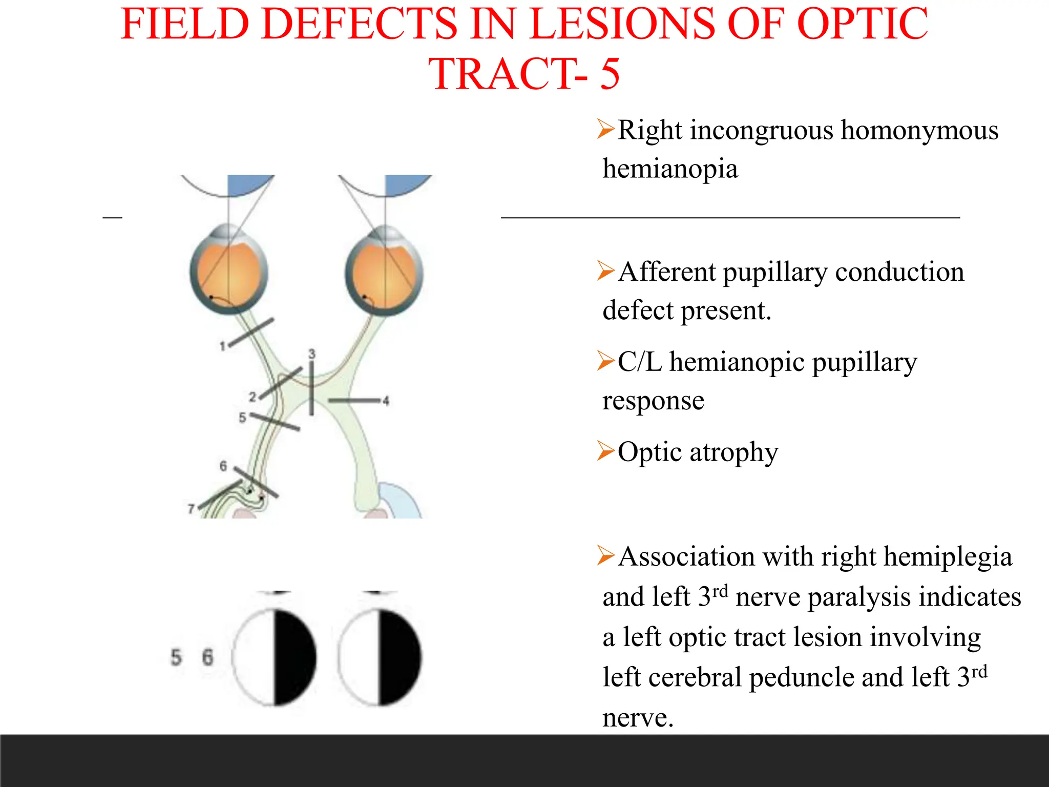 visual fields in neuro ophthalmology-part 1 | PPTX