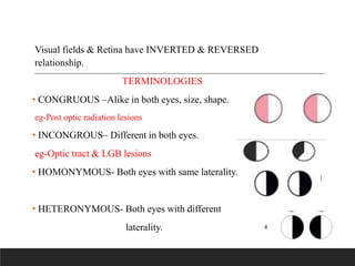 visual fields in neuro ophthalmology-part 1 | PPTX