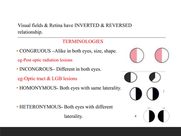 visual fields in neuro ophthalmology-part 1 | PPT