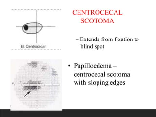visual fields in neuro ophthalmology-part 1 | PPTX