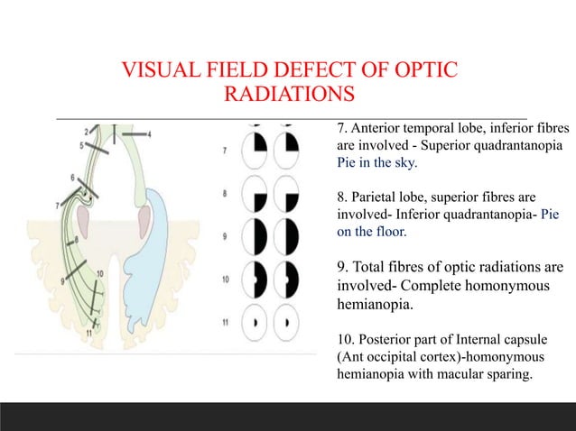 visual fields in neuro ophthalmology-part 1 | PPT