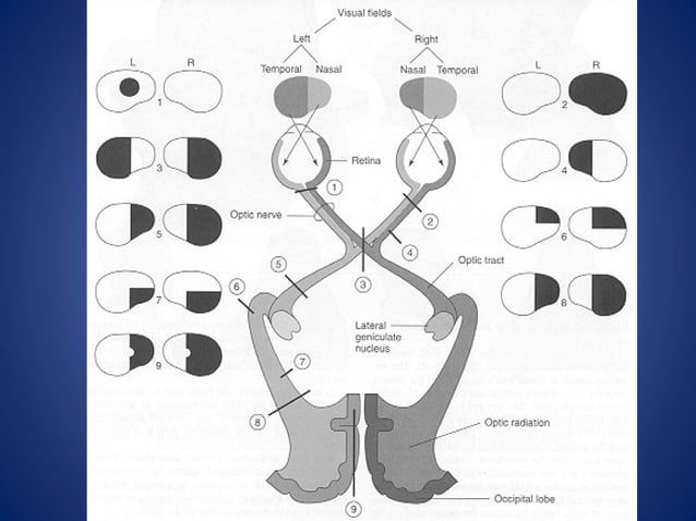 Visual field testing and interpretation | PPT