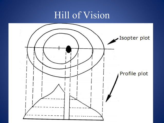 Visual field testing and interpretation | PPT