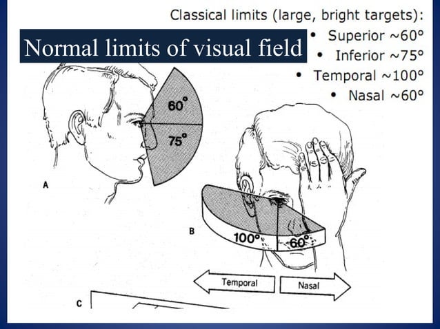 Visual field testing and interpretation | PPT