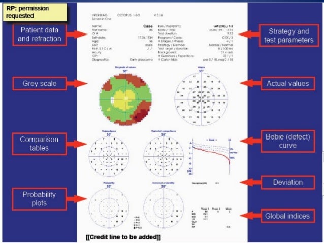 Visual Field Testing And Interpretation