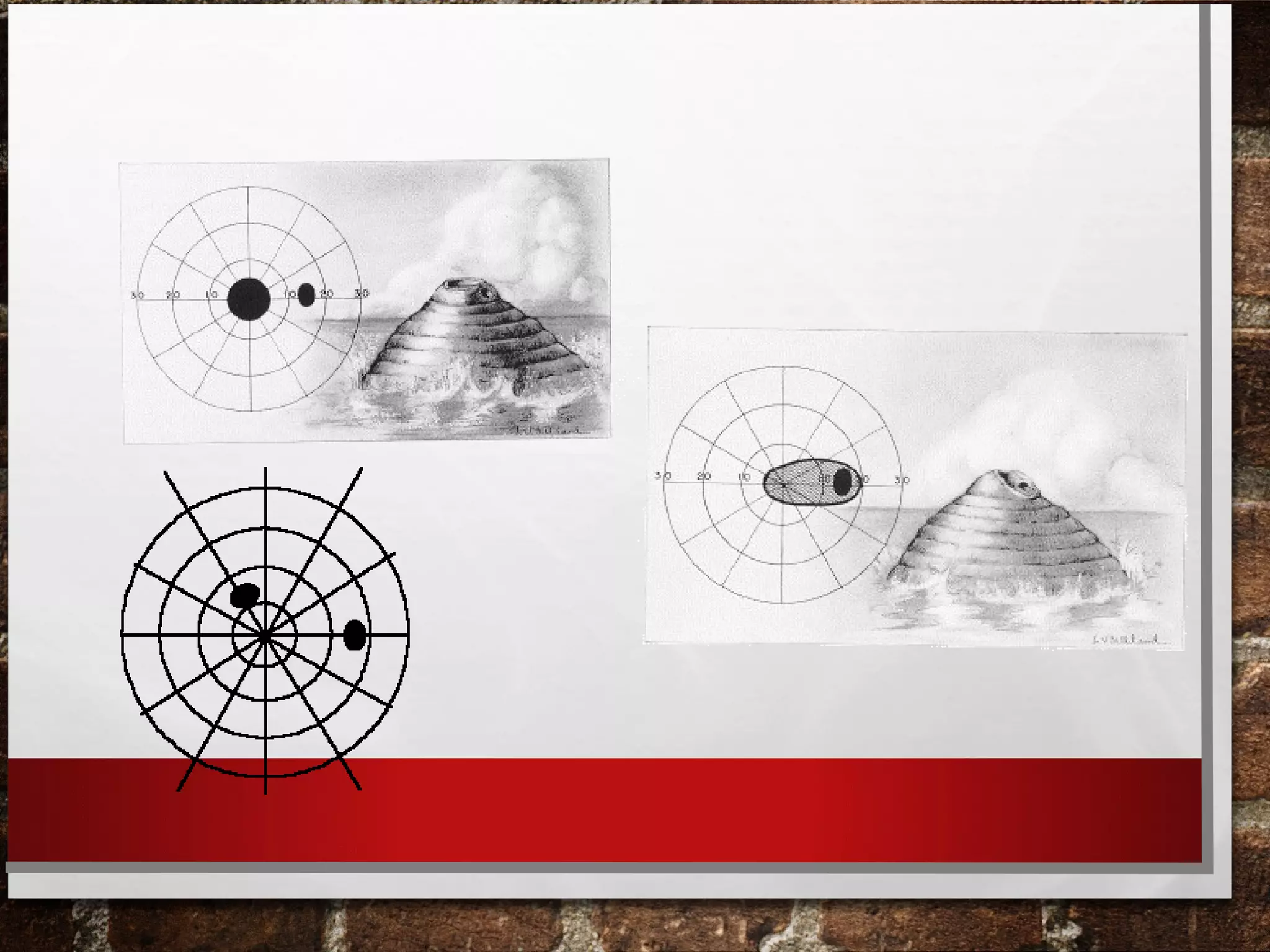Visual field testing and interpretation | PPT