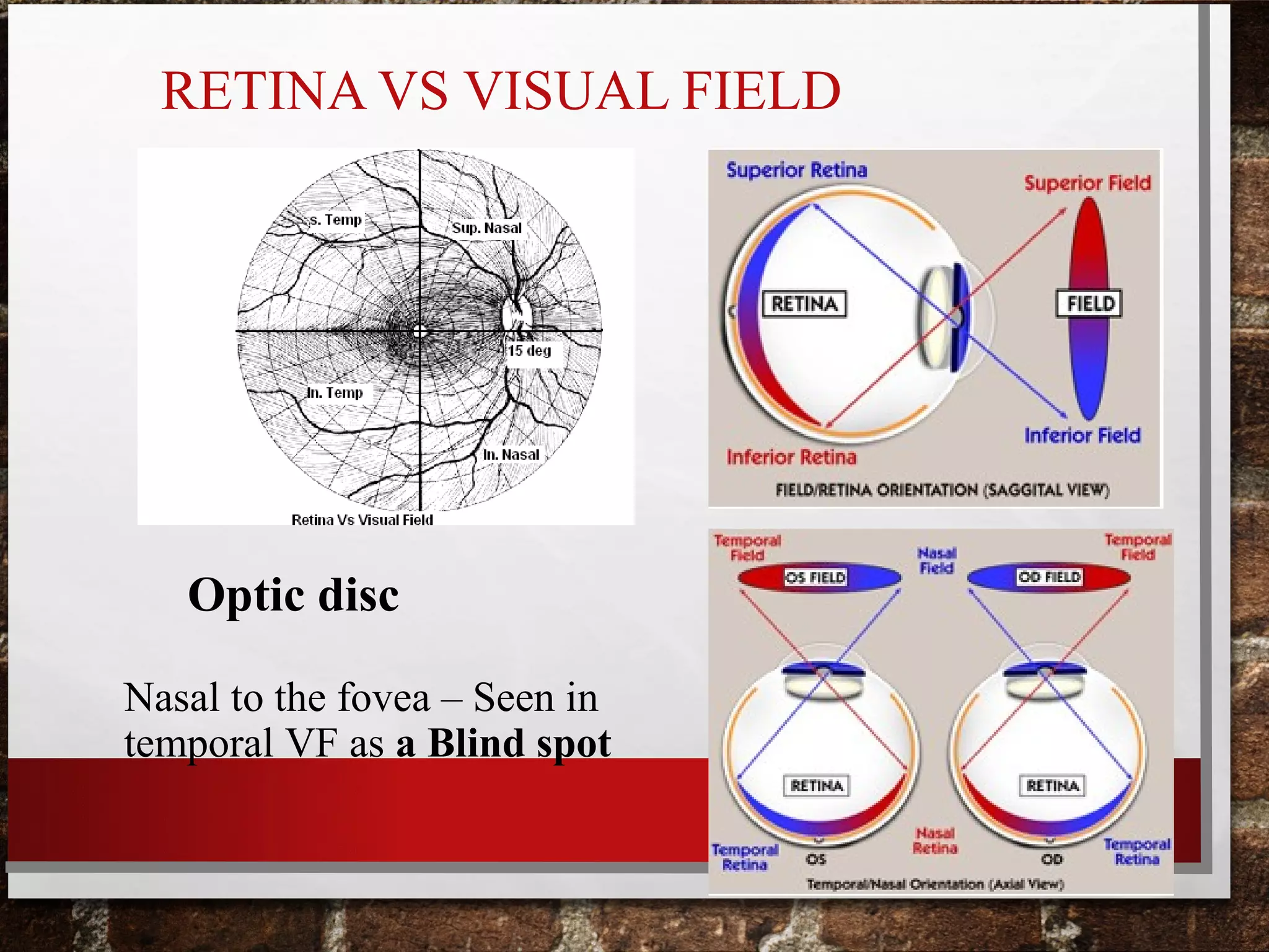 Visual field testing and interpretation | PPT
