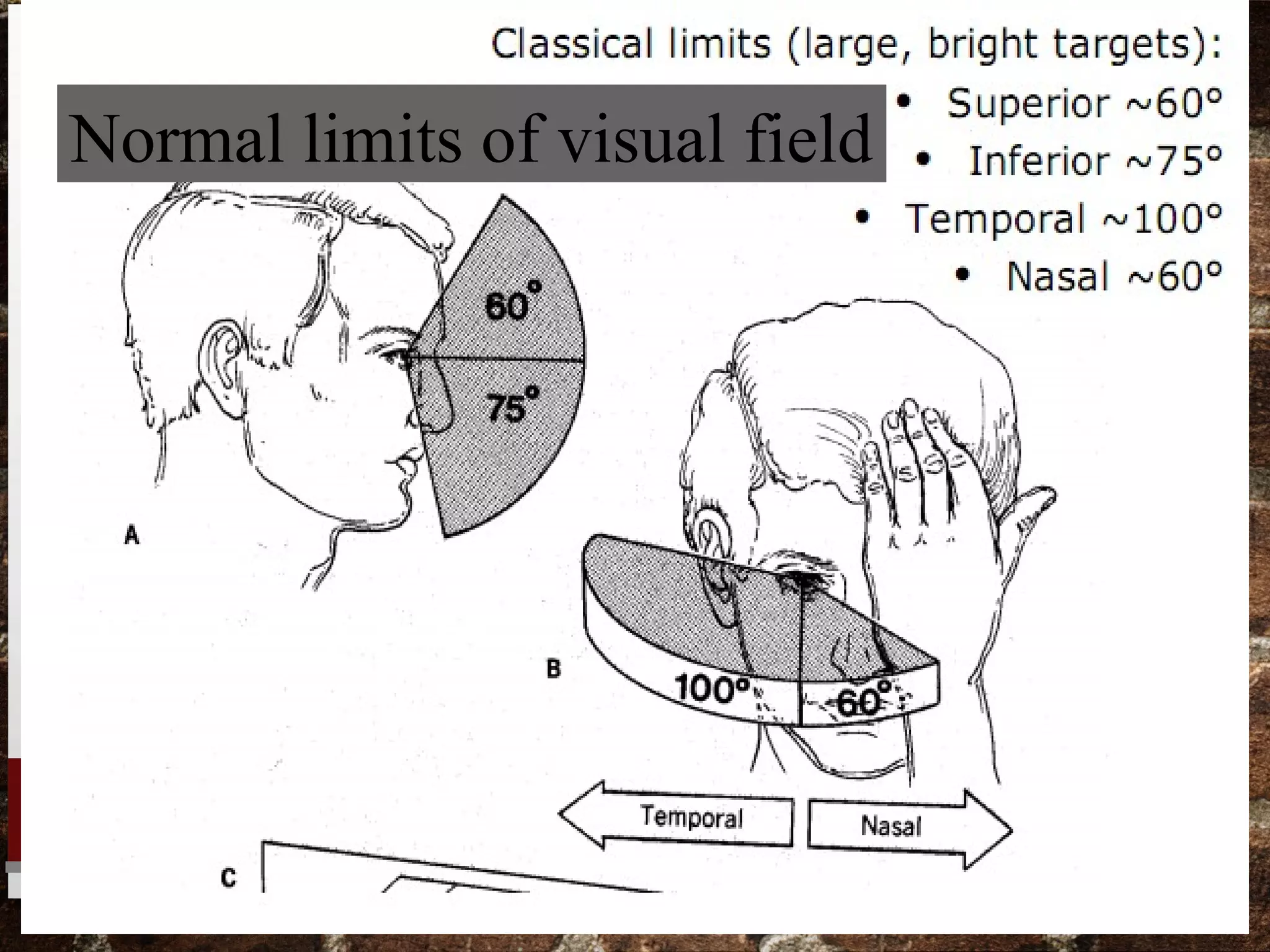 Visual field testing and interpretation | PPT