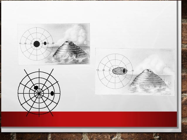 Visual field testing and interpretation | PPT | Eye and Vision ...