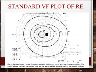 Visual field testing and interpretation | PPT