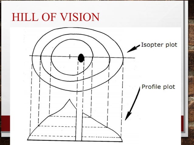 Visual field testing and interpretation | PPT | Eye and Vision ...