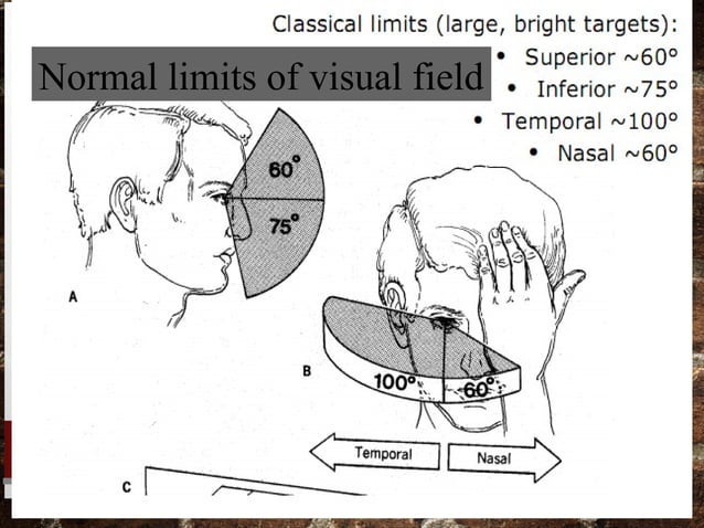 Visual field testing and interpretation | PPT | Eye and Vision ...