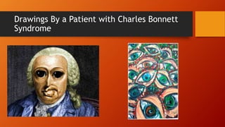 Visual hallucinations | PPTX