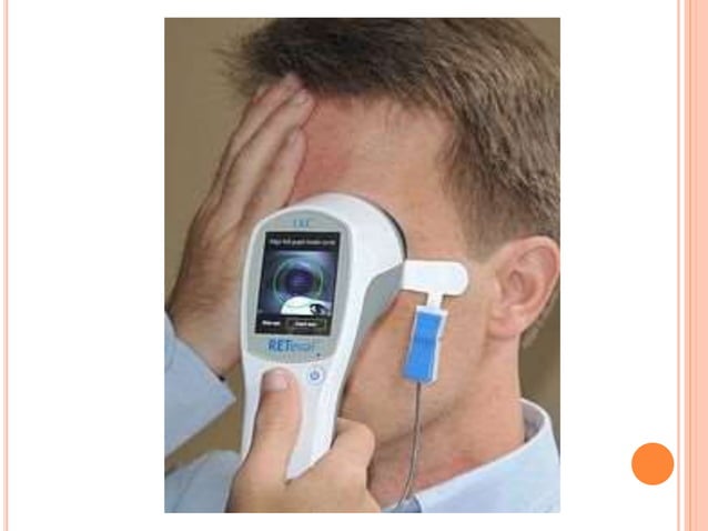 Visual hallucinations: Differential diagnosis & treatment | PPT