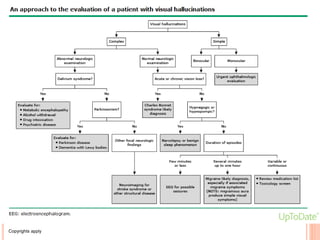 Visual hallucinations: Differential diagnosis & treatment | PPT