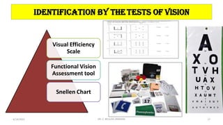 VISUAL IMPAIRMENT.pdf