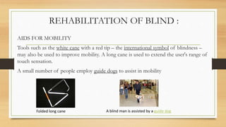 visual impairment .pptx