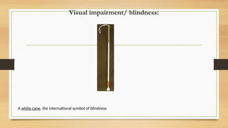 Nursing Management of visual impairment , | PPTX