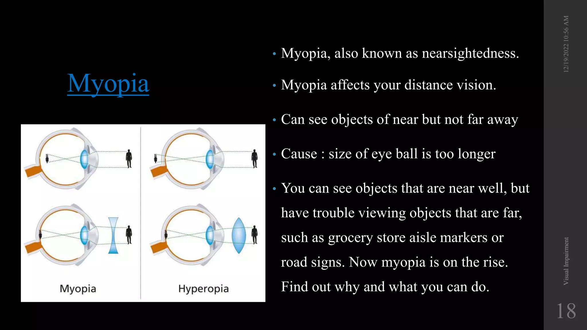 Visual Impairment | PPTX