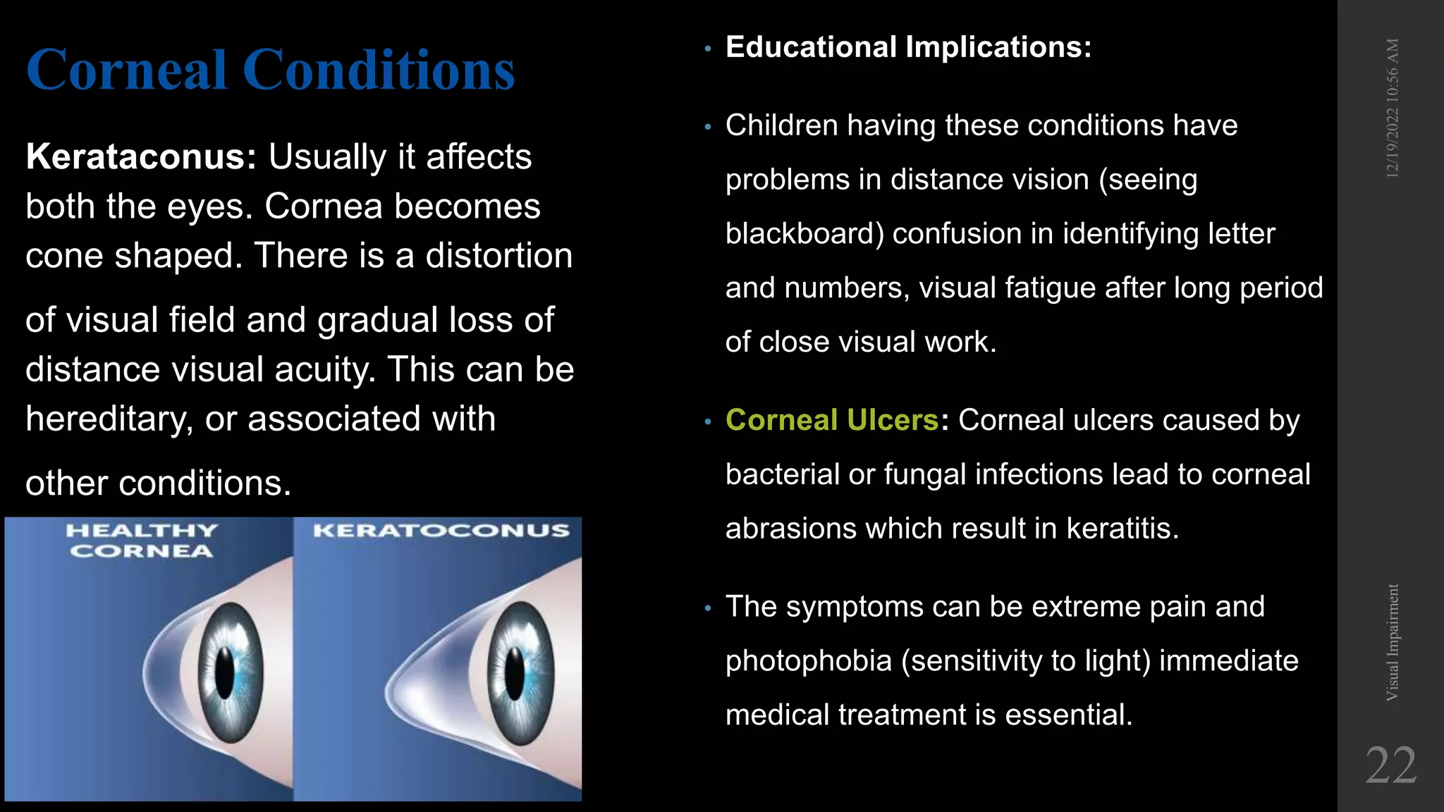 Visual Impairment | PPTX