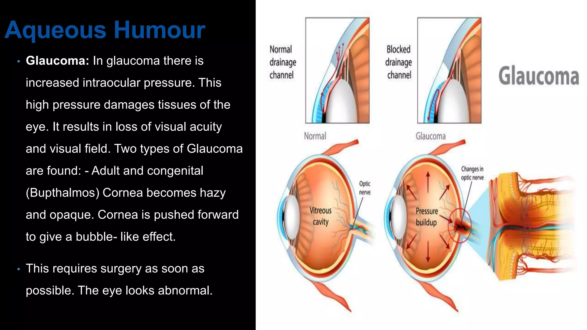Visual Impairment | PPTX