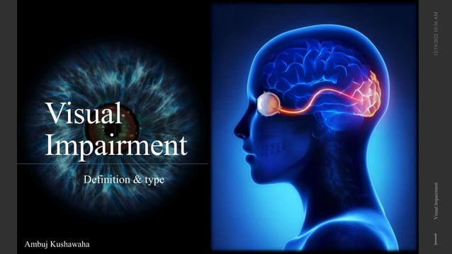 Visual Impairment | PPT