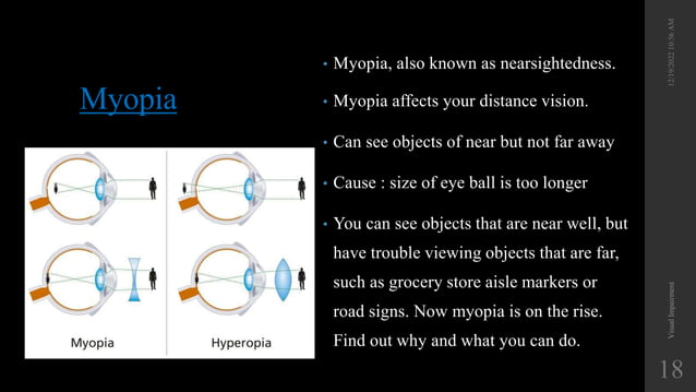 Visual Impairment | PPT