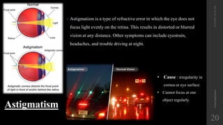 Visual Impairment | PPTX