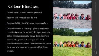 Visual Impairment | PPTX