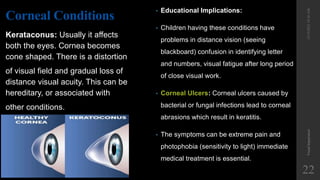 Visual Impairment | PPTX