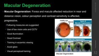 Visual Impairment | PPTX