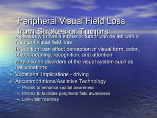 Visual impairment 2 | PPT