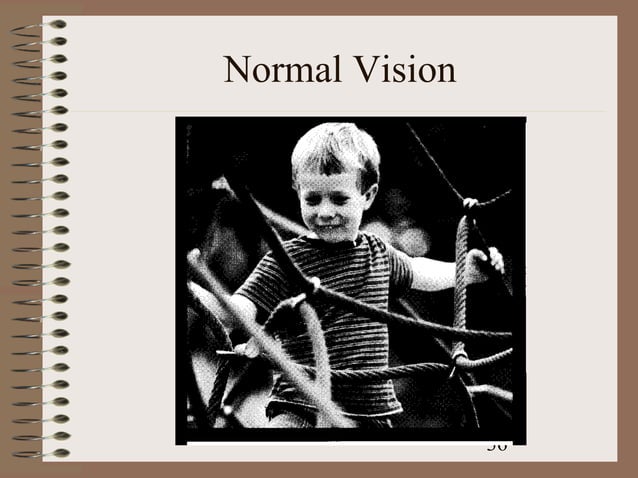 Visual impairments | PPT