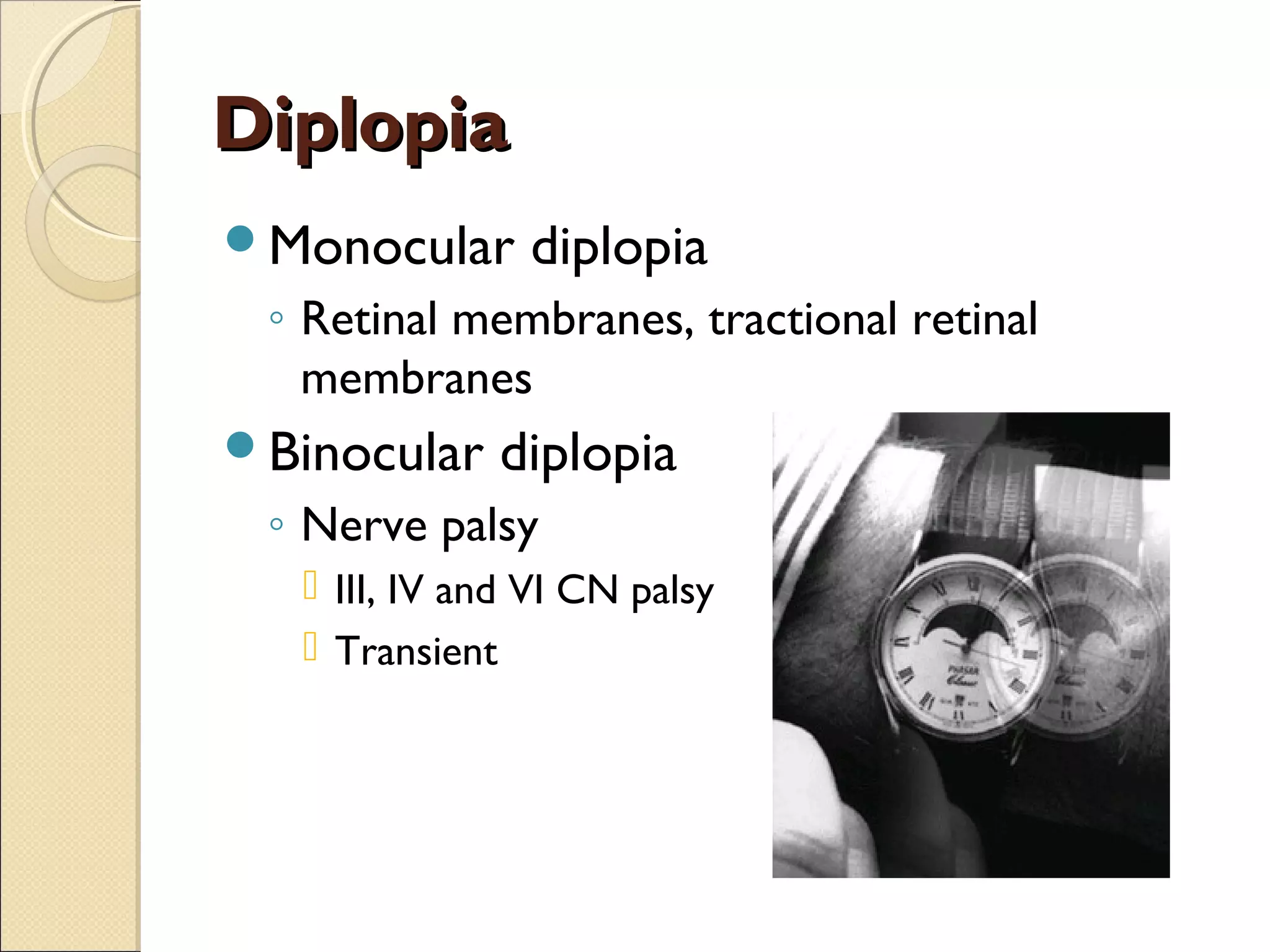 Visual Implication in Diabetes Mellitus | PPT