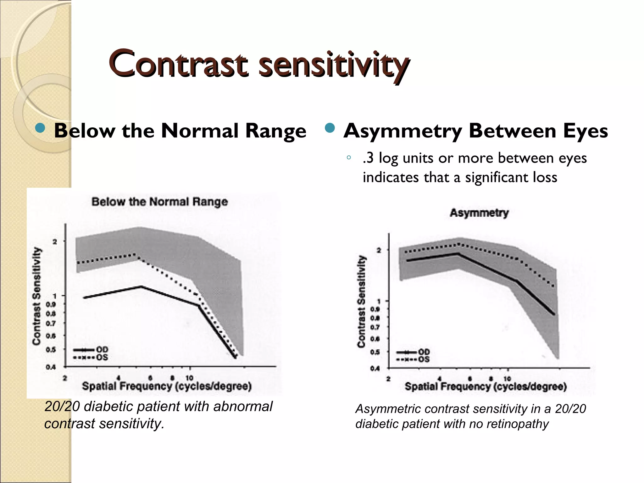Visual Implication in Diabetes Mellitus | PPT