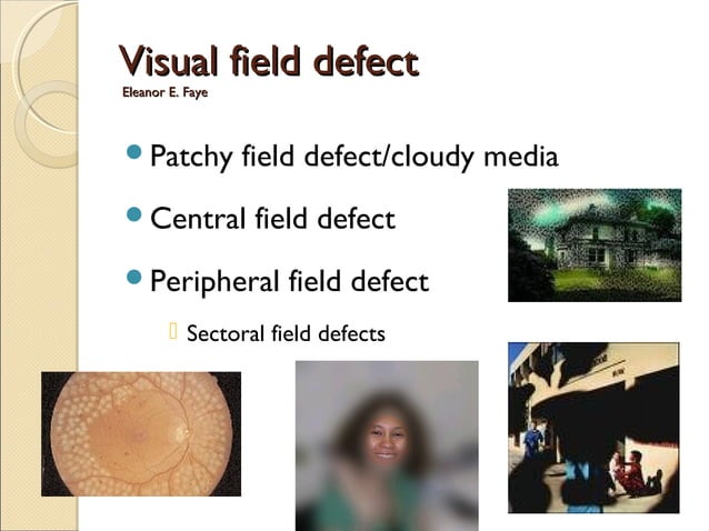 Visual Implication in Diabetes Mellitus | PPT